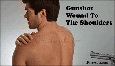 Gunshot Wound To The Shoulders GIF by ePainAssist - Find & Share on GIPHY