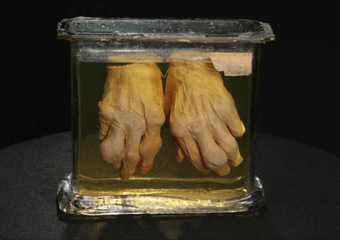 Hands Gout GIF by Mütter Museum - Find & Share on GIPHY