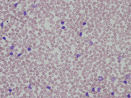 Red Blood Cells GIFs - Find & Share on GIPHY