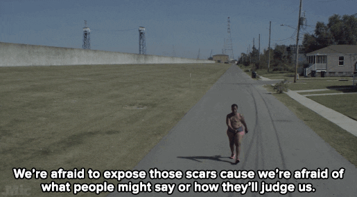 Mastectomy Scars GIFs - Get the best GIF on GIPHY