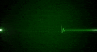 Heart Monitor Flatline Gif