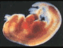 Fetus GIFs - Find & Share on GIPHY