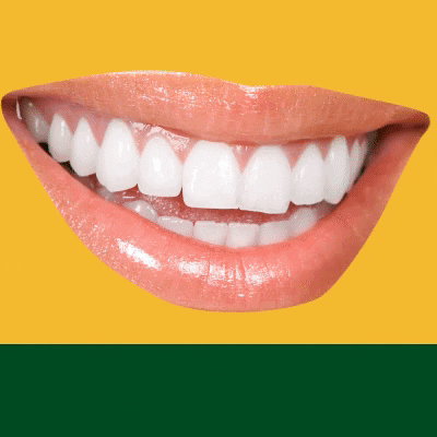 Teeth Whitening GIF by GOU Franquias - Find & Share on GIPHY