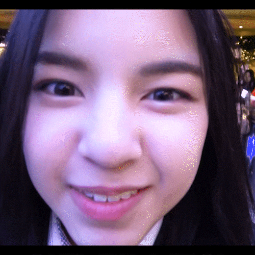 Malocclusion GIFs - Find & Share on GIPHY